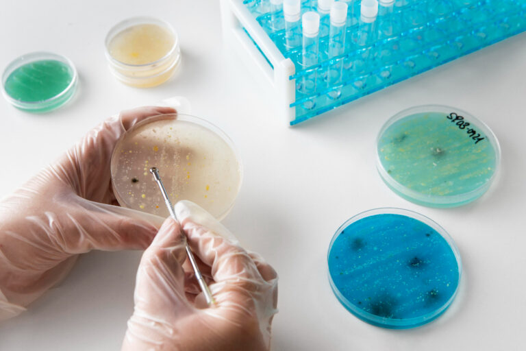 Sputum Culture Tests: Purpose, Procedure, and What to Expect ...